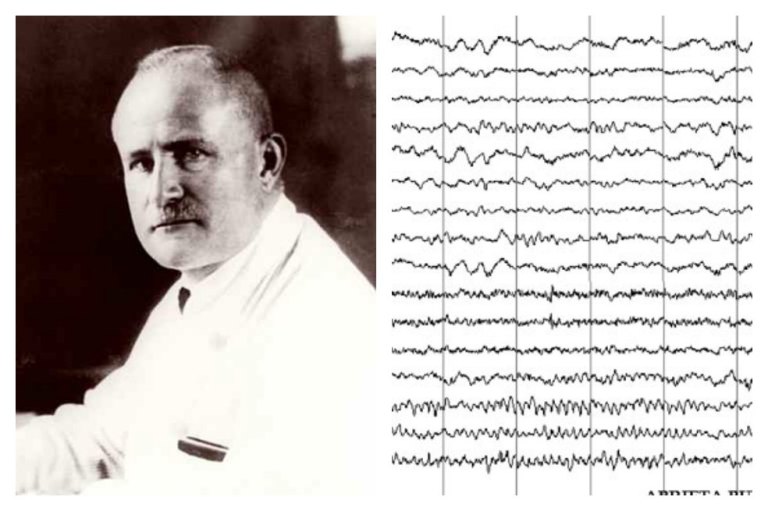 Hans Berger: el padre de la electroencefalografía – Sólo es Ciencia